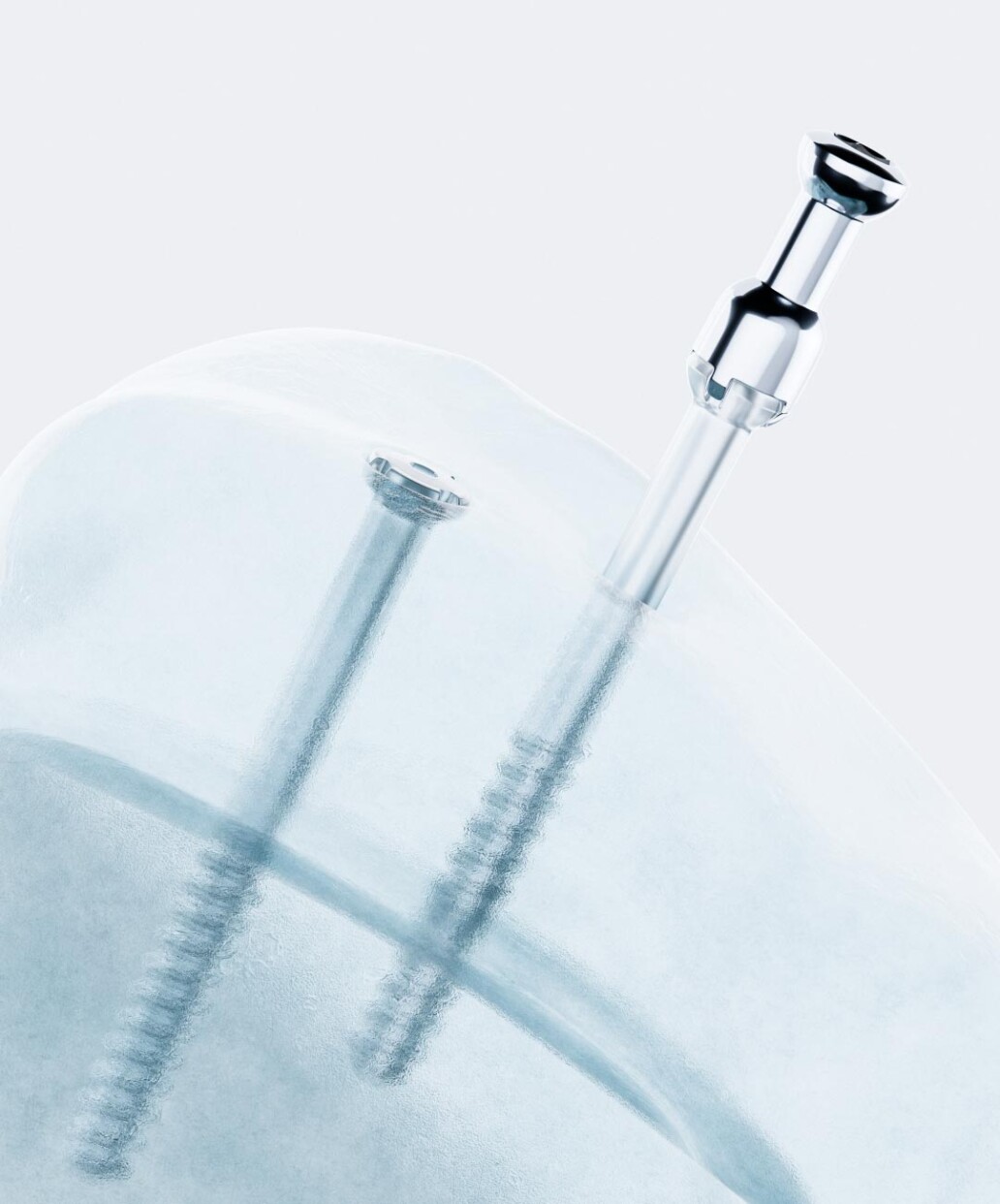 Activa Screw™ | Activa